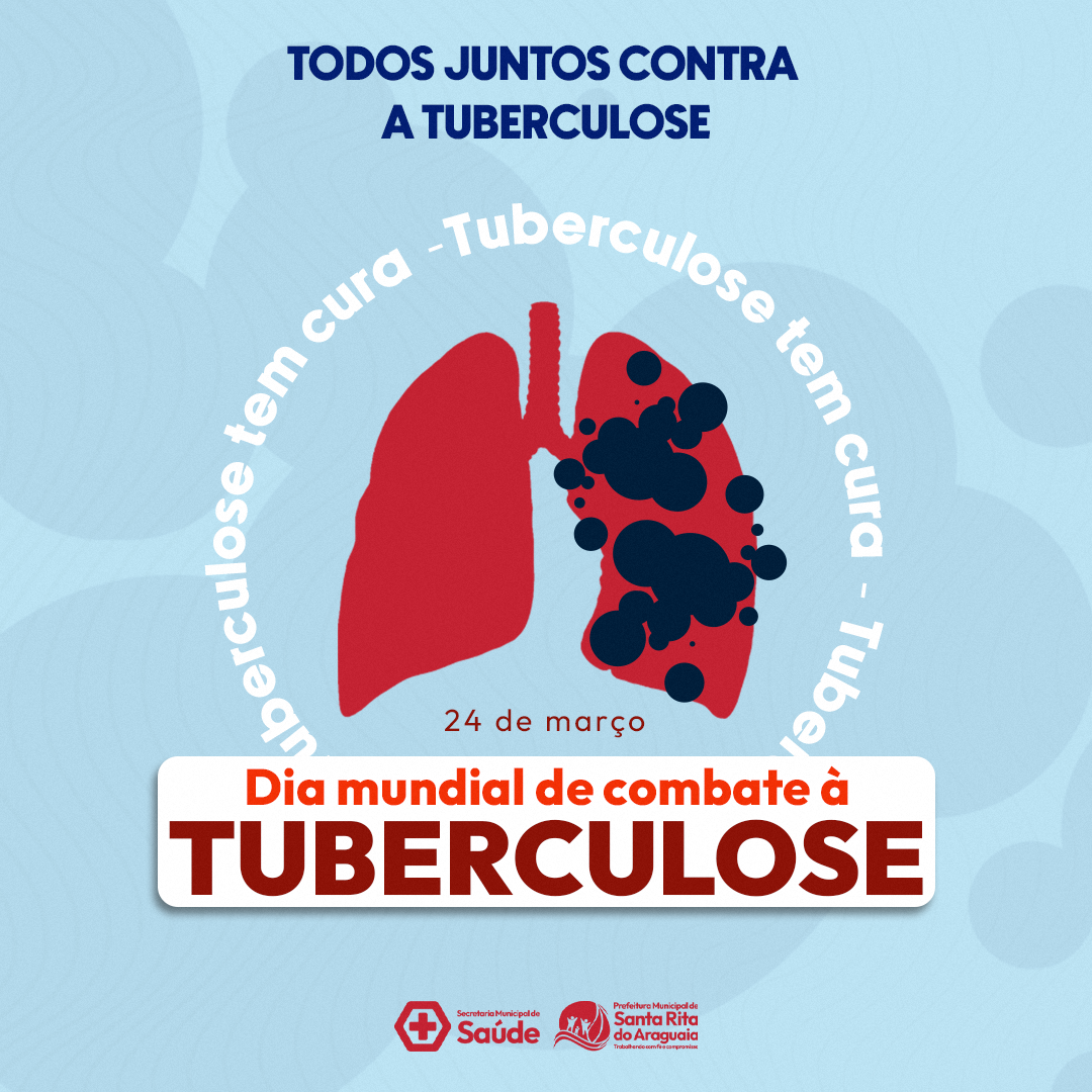 Dia Mundial De Combate à Tuberculose Prefeitura De Santa Rita Do Araguaia